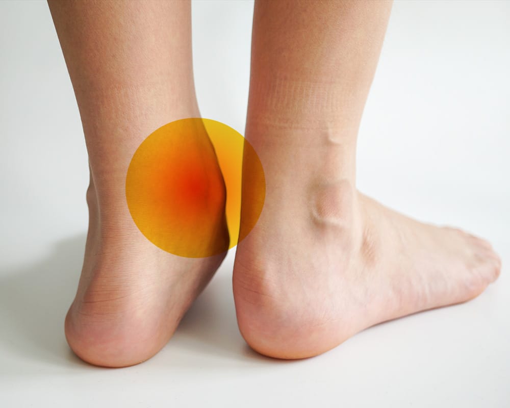 Knick-Senkfuß: Was muss man wissen? was ist zu tun? - Orthopädie ...